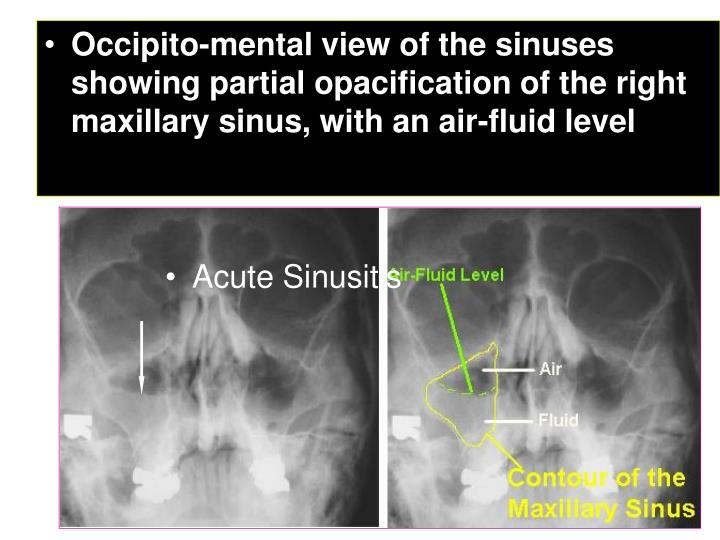 PPT - Radiology of The Ear PowerPoint Presentation - ID:627205