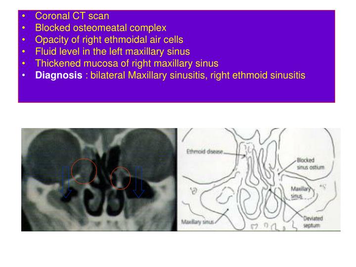 PPT - Radiology of The Ear PowerPoint Presentation - ID:627205