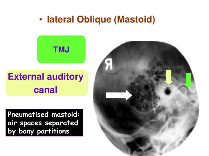 PPT - Radiology of The Ear PowerPoint Presentation - ID:627205