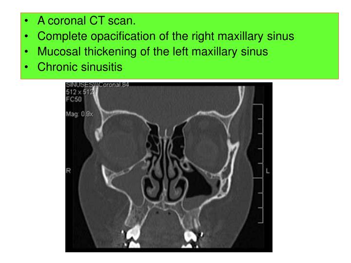 PPT - Radiology of The Ear PowerPoint Presentation - ID:627205