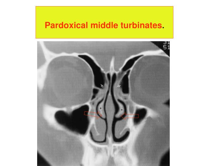 PPT - Radiology of The Ear PowerPoint Presentation - ID:627205