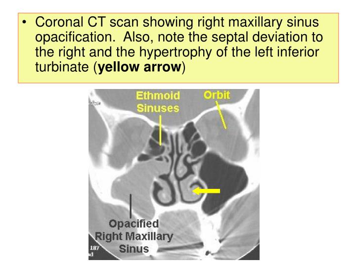 PPT - Radiology of The Ear PowerPoint Presentation - ID:627205