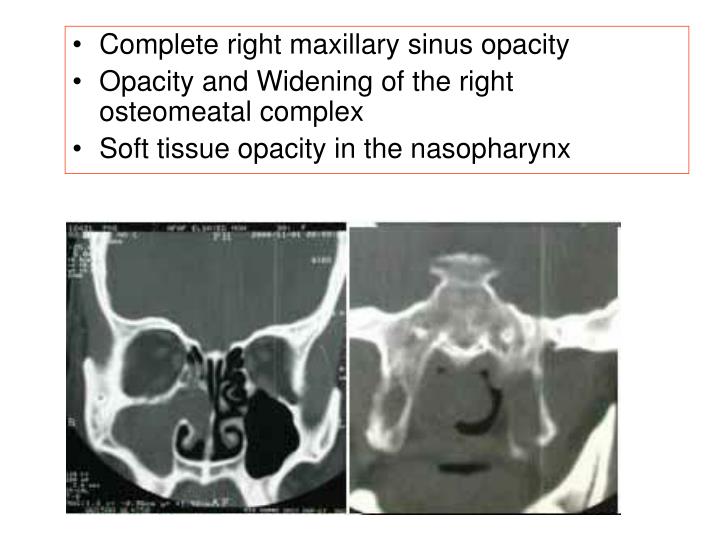 PPT - Radiology of The Ear PowerPoint Presentation - ID:627205