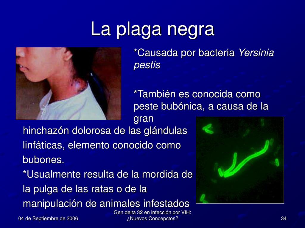 PPT - “Gen delta 32 e infección VIH: ¿Nuevos Conceptos?” PowerPoint ...