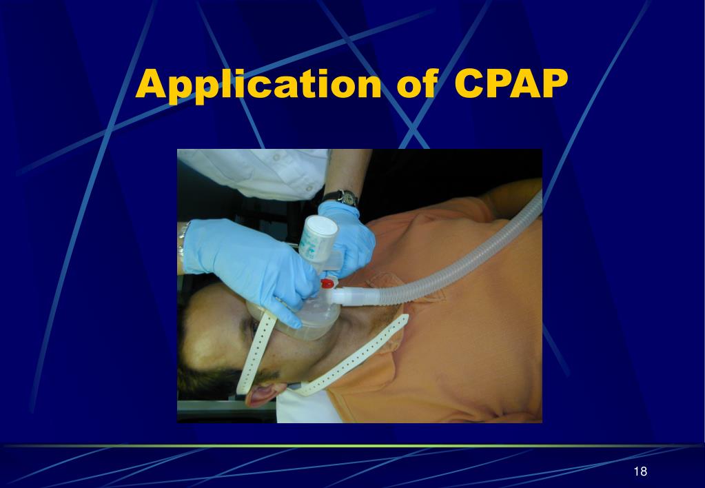 Ppt Cpap Powerpoint Presentation Free Download Id 630147
