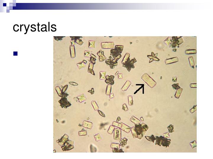 PPT - Urine analysis PowerPoint Presentation - ID:632788