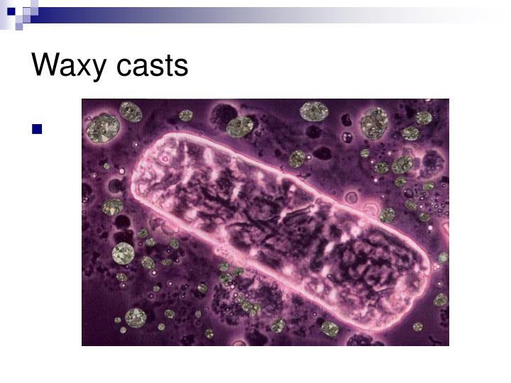 PPT - Urine analysis PowerPoint Presentation - ID:632788