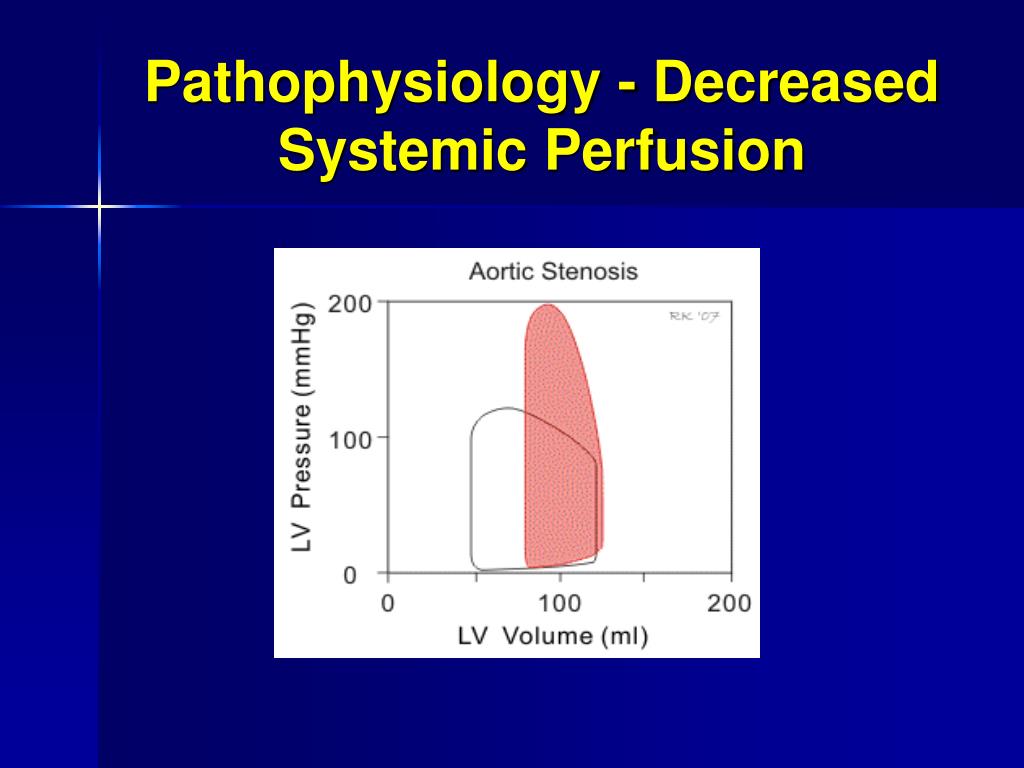 PPT - Aortic Stenosis Audrone LaForgia, MD Advisor: Dr. Nelson CICU ...