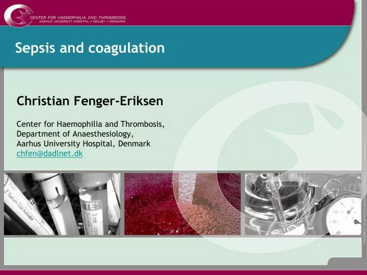 PPT - Sepsis and coagulation PowerPoint Presentation, free download ...