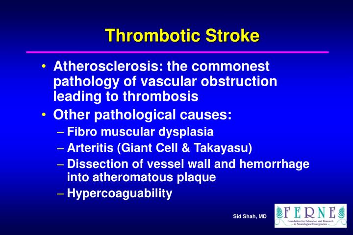PPT - Pathogenesis of Stroke: Ischemia & Hemorrhage PowerPoint ...