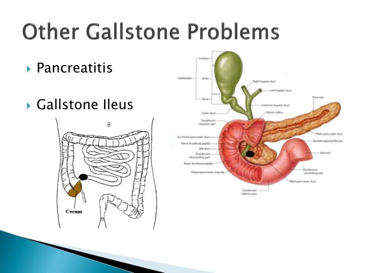 PPT - The Liver, Gallbladder and Biliary Tree PowerPoint Presentation ...