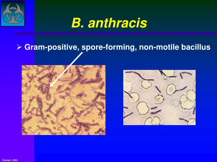 PPT - Laboratory Criteria for Identification of B. anthracis PowerPoint ...