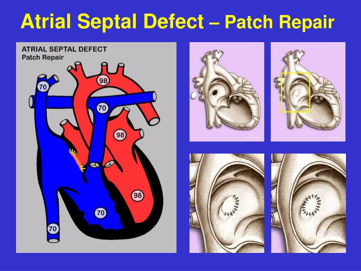 PPT - Surgical Procedures PowerPoint Presentation - ID:640635