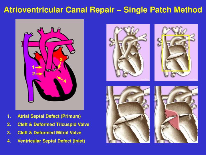 PPT - Surgical Procedures PowerPoint Presentation - ID:640635