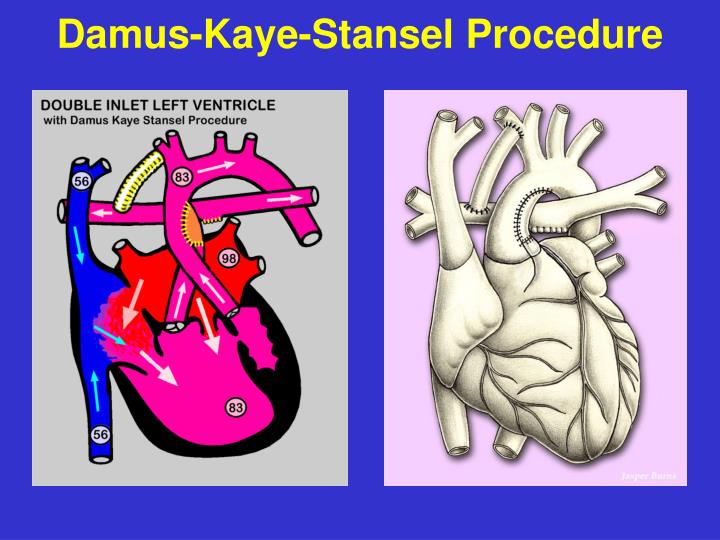 PPT - Surgical Procedures PowerPoint Presentation - ID:640635