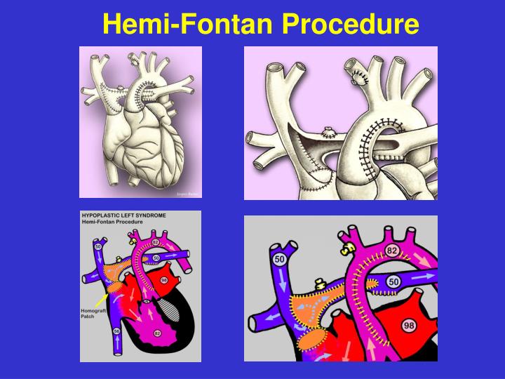 PPT - Surgical Procedures PowerPoint Presentation - ID:640635