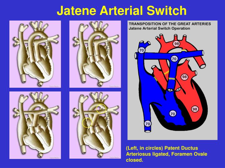 PPT - Surgical Procedures PowerPoint Presentation - ID:640635