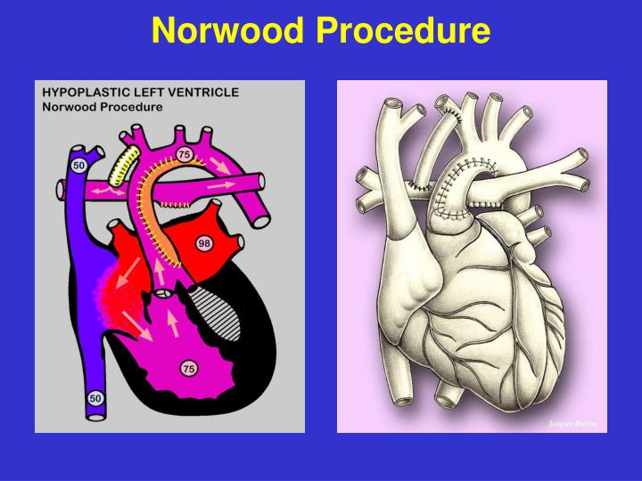 PPT - Surgical Procedures PowerPoint Presentation - ID:640635