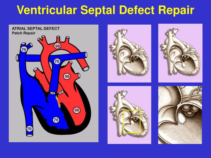 PPT - Surgical Procedures PowerPoint Presentation - ID:640635