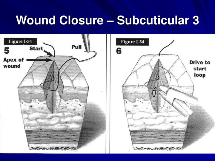 PPT - Suture Workshop Intermediate Skills PowerPoint Presentation - ID ...