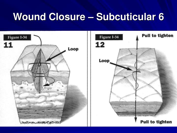 PPT - Suture Workshop Intermediate Skills PowerPoint Presentation - ID ...