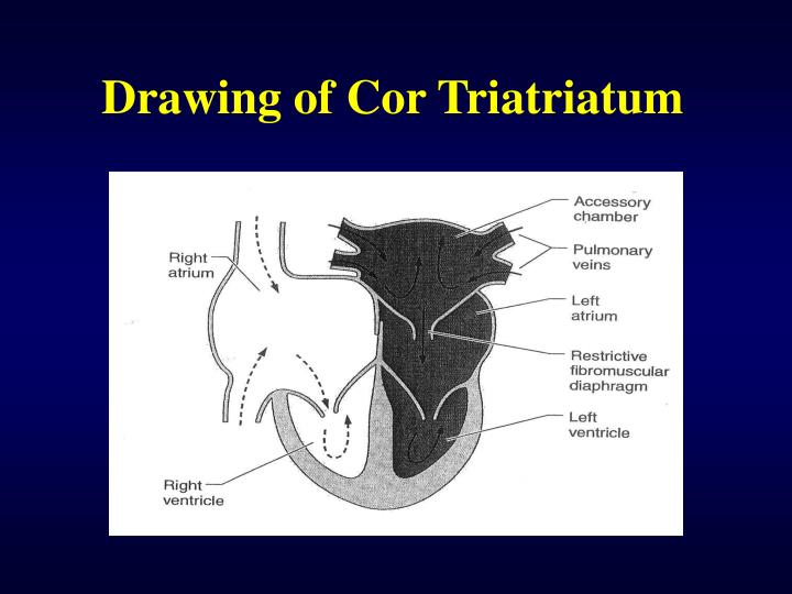 PPT - Cor Triatriatum PowerPoint Presentation - ID:645287