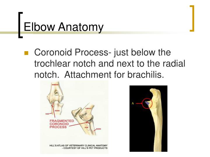 PPT - Elbow Joint PowerPoint Presentation - ID:645385