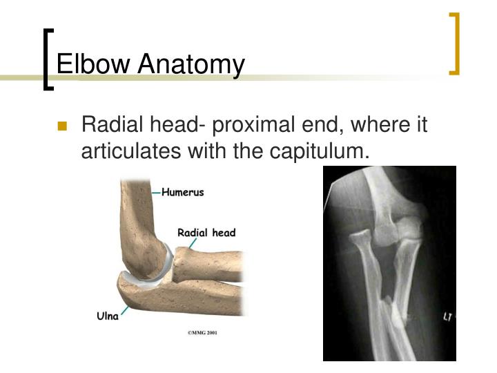 PPT - Elbow Joint PowerPoint Presentation - ID:645385