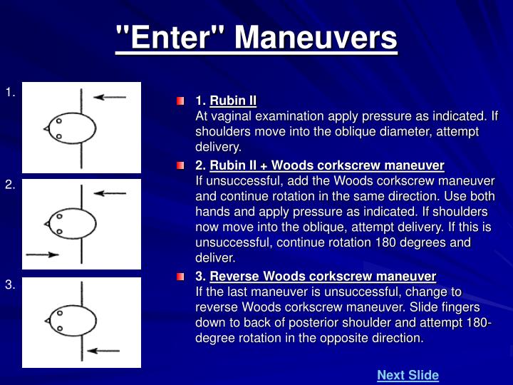 PPT - Fun with Shoulder Dystocia PowerPoint Presentation - ID:645424