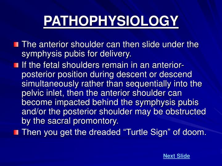 PPT - Fun with Shoulder Dystocia PowerPoint Presentation - ID:645424