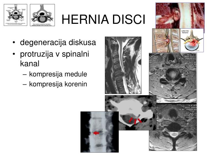 PPT - POVZETEK PowerPoint Presentation - ID:648890