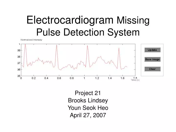 PPT - Electrocardiogram Missing Pulse Detection System PowerPoint ...