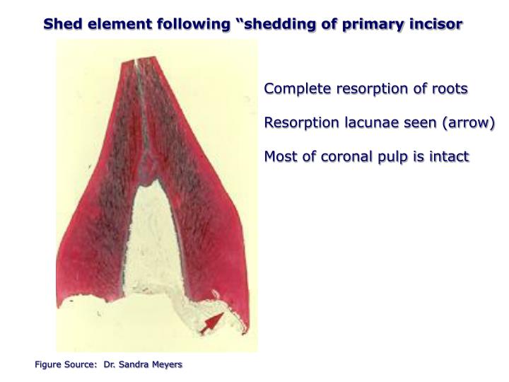PPT - Eruption and Shedding of Teeth PowerPoint Presentation - ID:653192