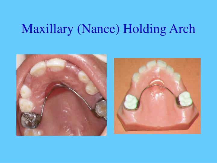 PPT - Space Maintenance PowerPoint Presentation - ID:653220