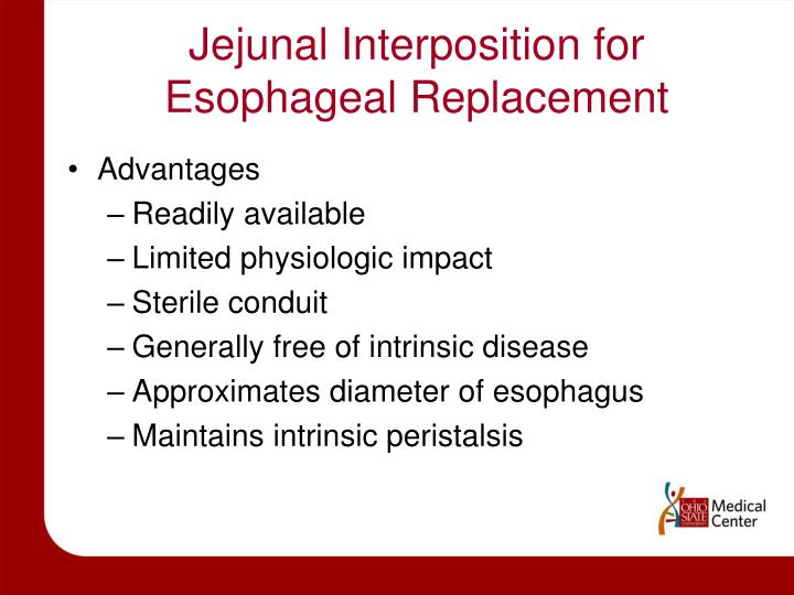 PPT - Surgical Intervention for Esophageal Cancer PowerPoint ...
