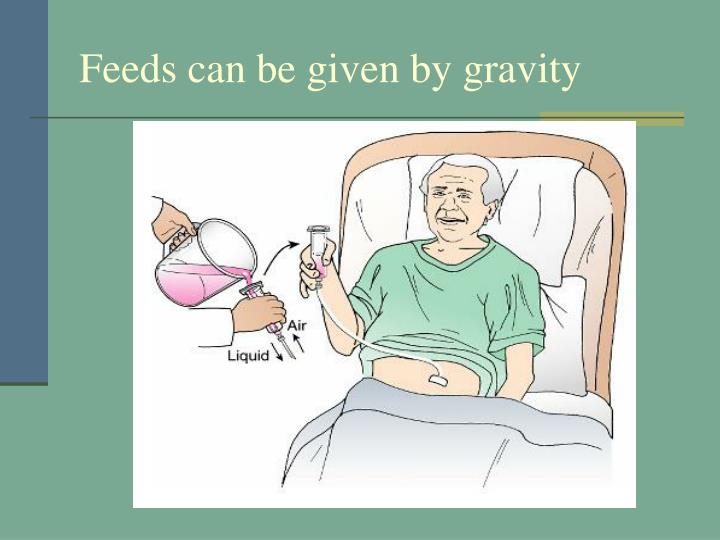 PPT - Gastrointestinal Intubation Nasogastric tubes PowerPoint ...