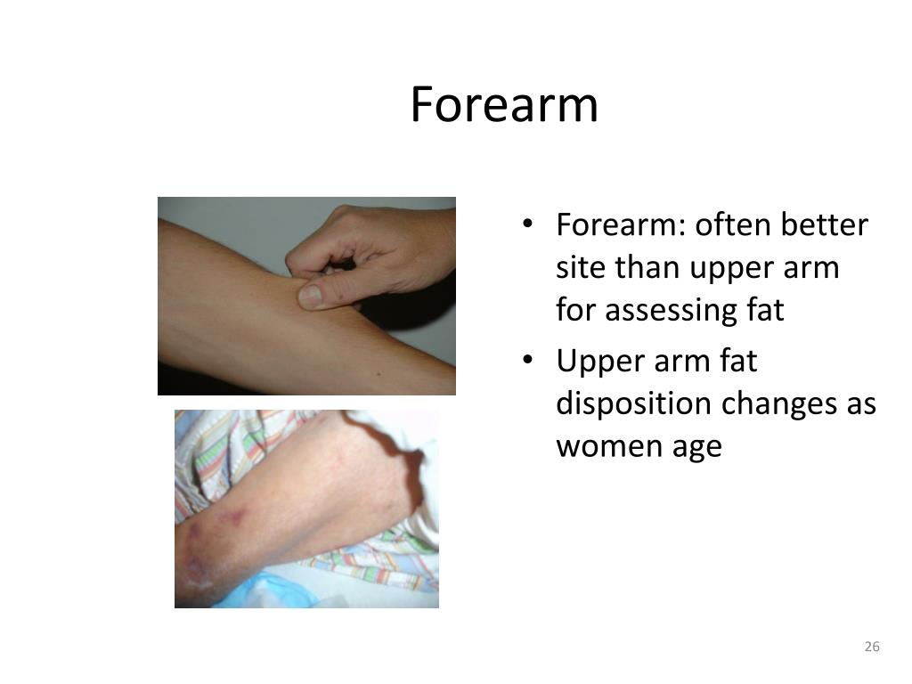 PPT - Nutrition Assessment in the Inpatient Setting Patient’s with ...