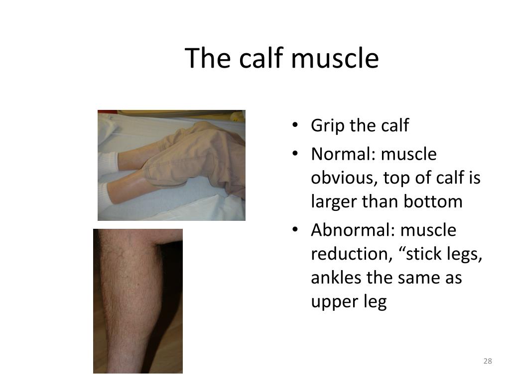 PPT - Nutrition Assessment in the Inpatient Setting Patient’s with ...