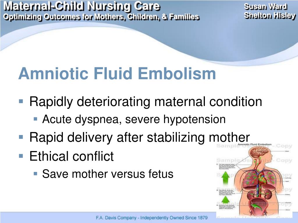 PPT - Chapter 14 PowerPoint Presentation, free download - ID:659694