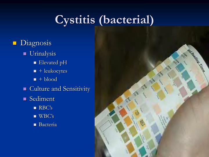 PPT - Diseases of the Urinary System PowerPoint Presentation - ID:660941