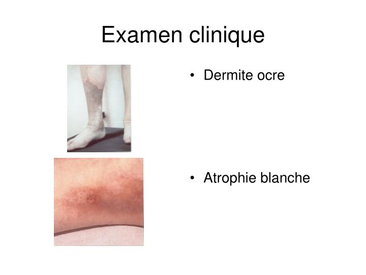 PPT - COURS SEMIOLOGIE PATHOLOGIE ANEVRISMALE PATHOLOGIE VEINEUSE ...