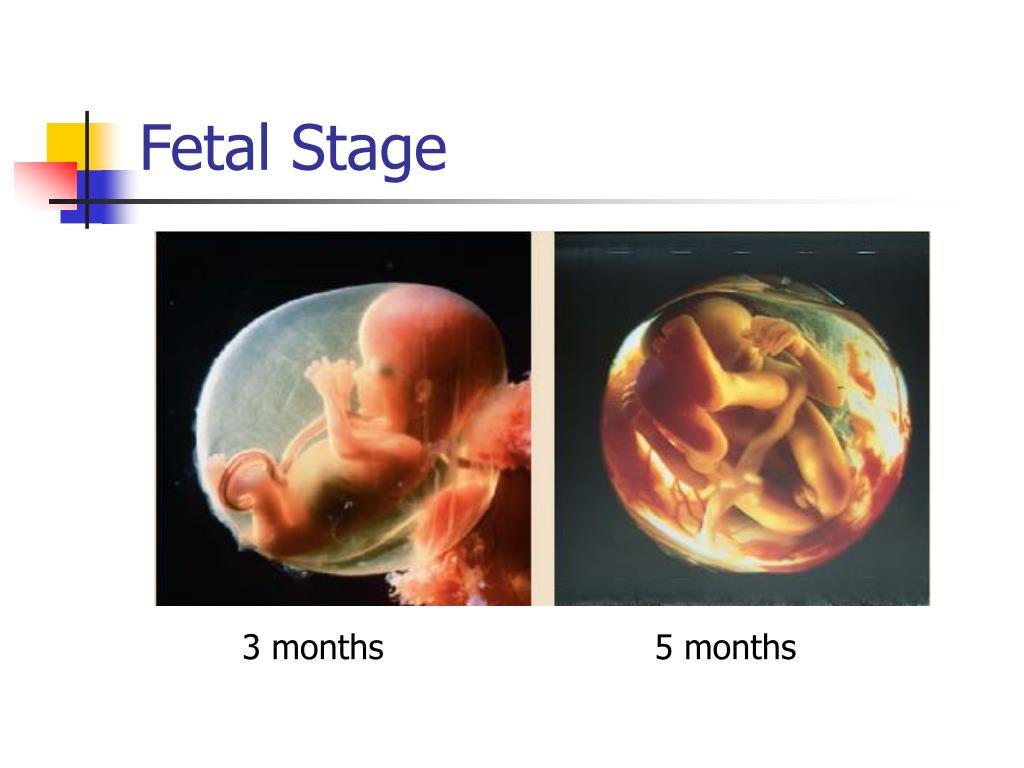 PPT - Chapter 3: Prenatal Development and Birth PowerPoint Presentation ... PPT - Chapter 3: Prenatal Development and Birth PowerPoint Presentation ...