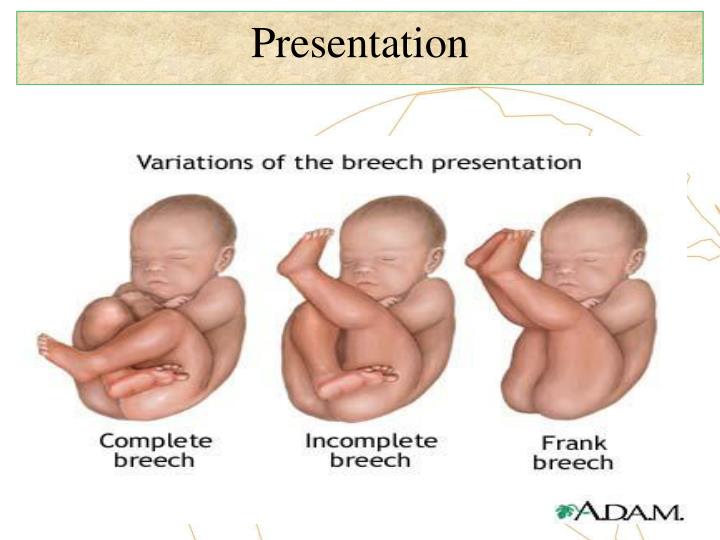 PPT - Lie, Presentation, Position, Attitude and Denominator PowerPoint ...