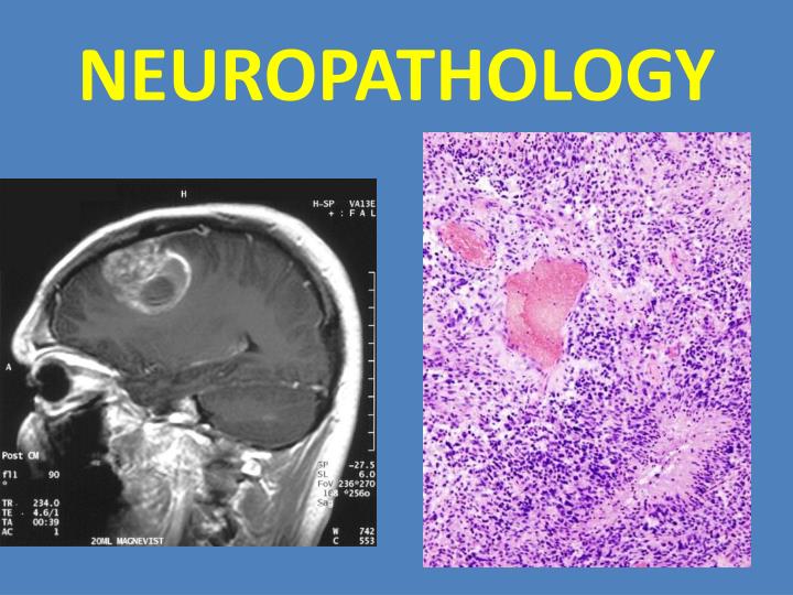 PPT - PATHOLOGY PowerPoint Presentation - ID:669953