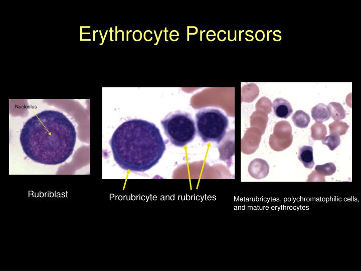 PPT - Bone Marrow Evaluation PowerPoint Presentation - ID:671342