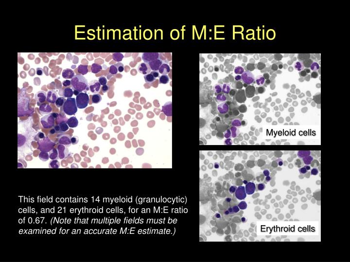PPT - Bone Marrow Evaluation PowerPoint Presentation - ID:671342