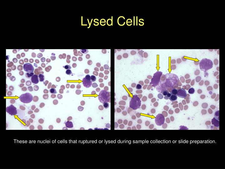PPT - Bone Marrow Evaluation PowerPoint Presentation - ID:671342