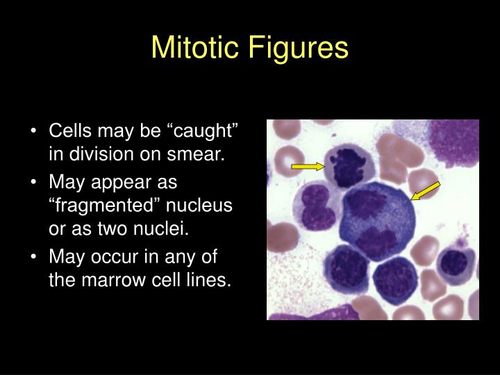 PPT - Bone Marrow Evaluation PowerPoint Presentation - ID:671342