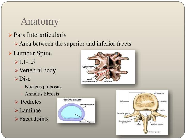 PPT - Physiotherapy of Spondylolysis PowerPoint Presentation - ID:672840