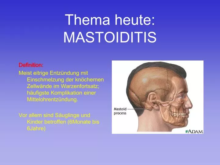 PPT - Thema heute: MASTOIDITIS PowerPoint Presentation - ID:675959